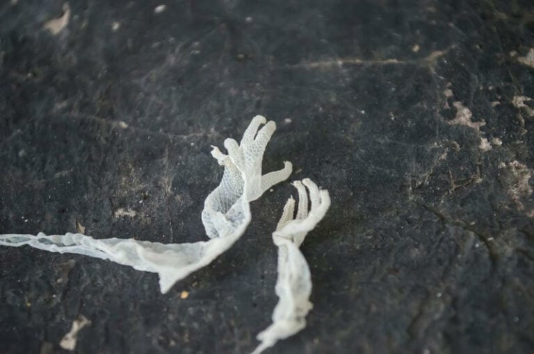 Leopard Gecko Shedding: How To Make Sure It Goes Well